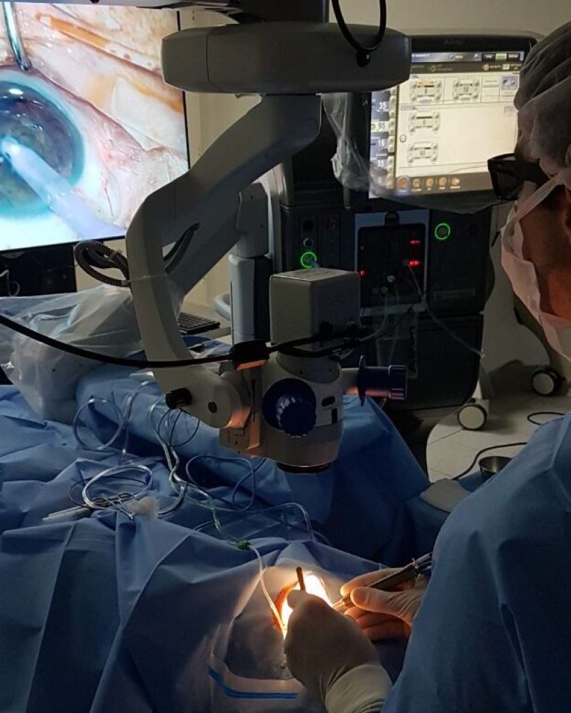 Cirurgia de Catarata em Sergipe